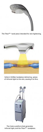 SkinTyte & Titan in Porter Ranch | Nu Vela Laser Medical Spa